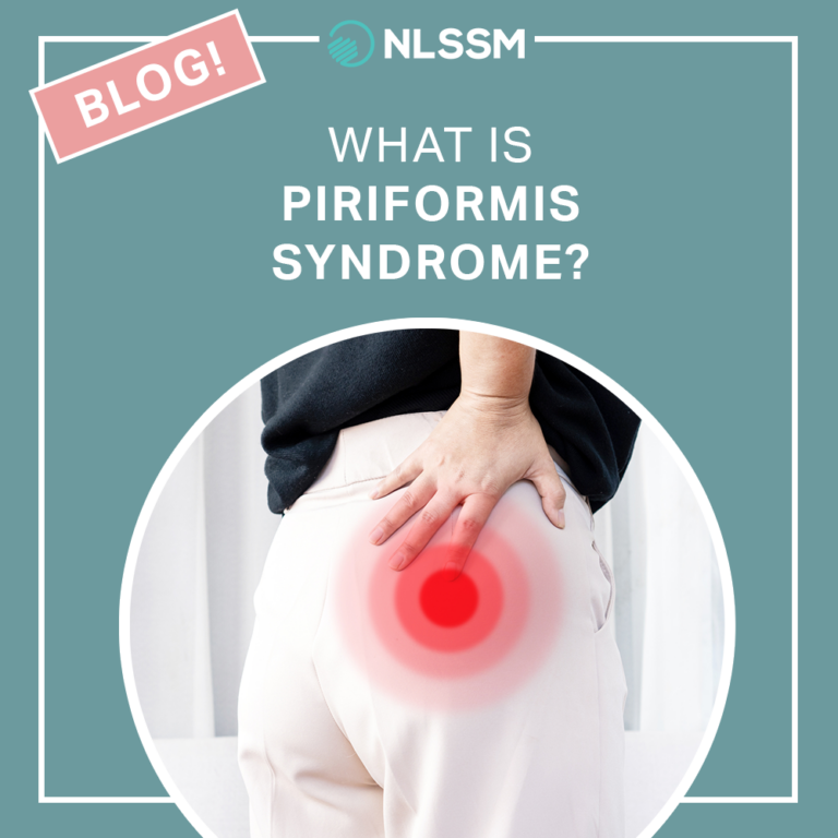 What is Piriformis Syndrome? - NLSSM