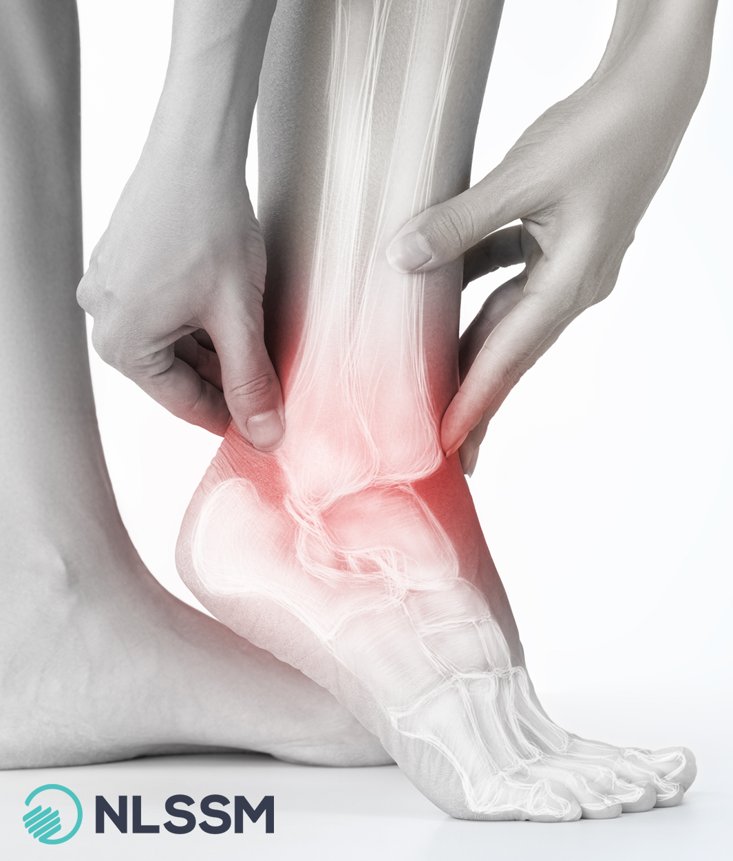 Top 5 Treatment Protocols for the Knee, Foot and Ankle - NLSSM